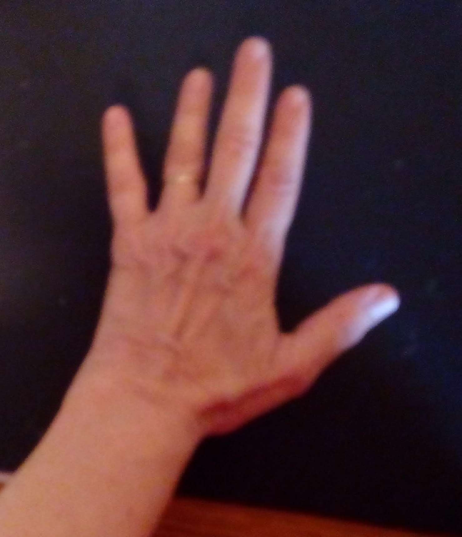 Essential tremor | Energy Guidance Complete